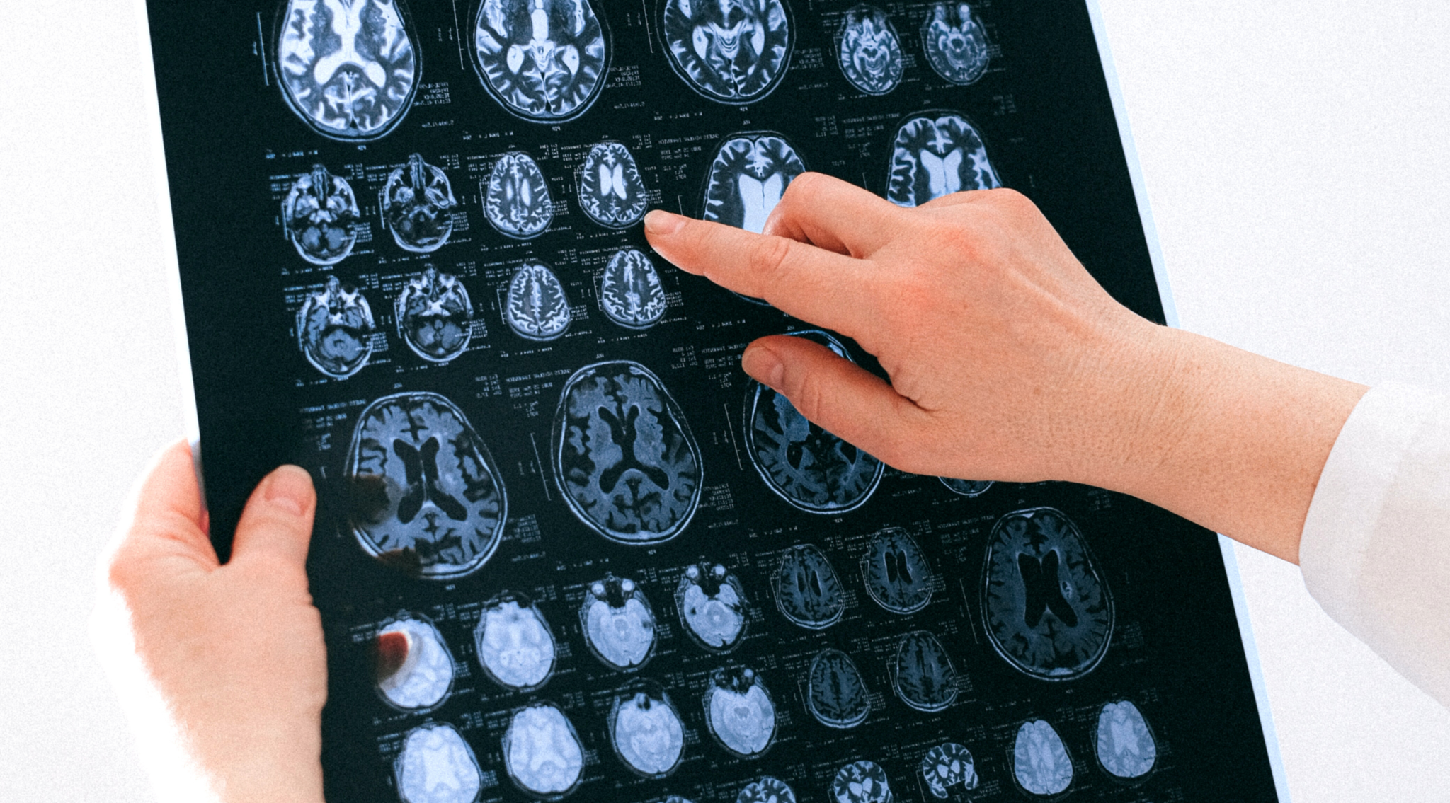 Produits de contraste : des médicaments pour y voir plus clair : IMASUD ...